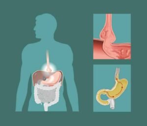 Zwerchfell – Alles über das Zwerchfell, seine Funktion, Anatomie und ...